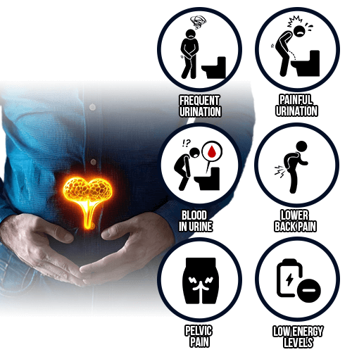 Biosigla Prostate Health - #1 Prostate Health Support