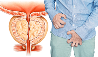 Biosigla Prostate Health - #1 Prostate Health Support